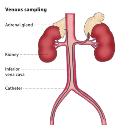 VENOUS SAMPLING - PKLI&RC